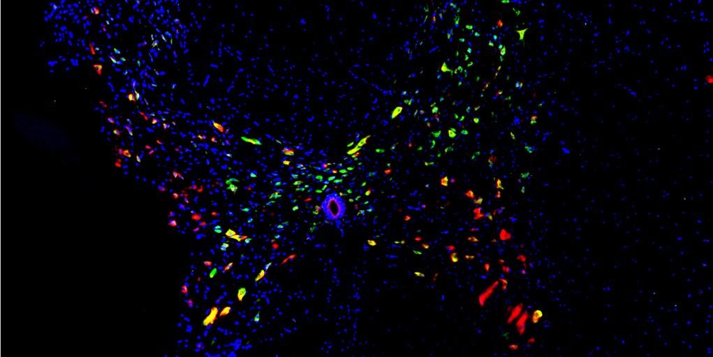 Premian la foto de la médula de una rata en forma de mariposa hecha por ...