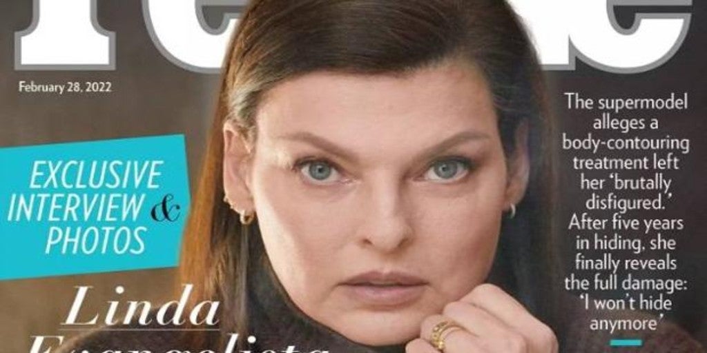 Linda Evangelista enseña por primera vez su cuerpo tras quedar ...