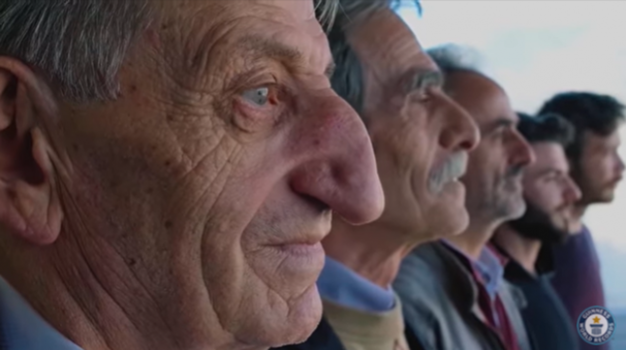 El hombre de la nariz más larga del mundo: «Dios me hizo así»
