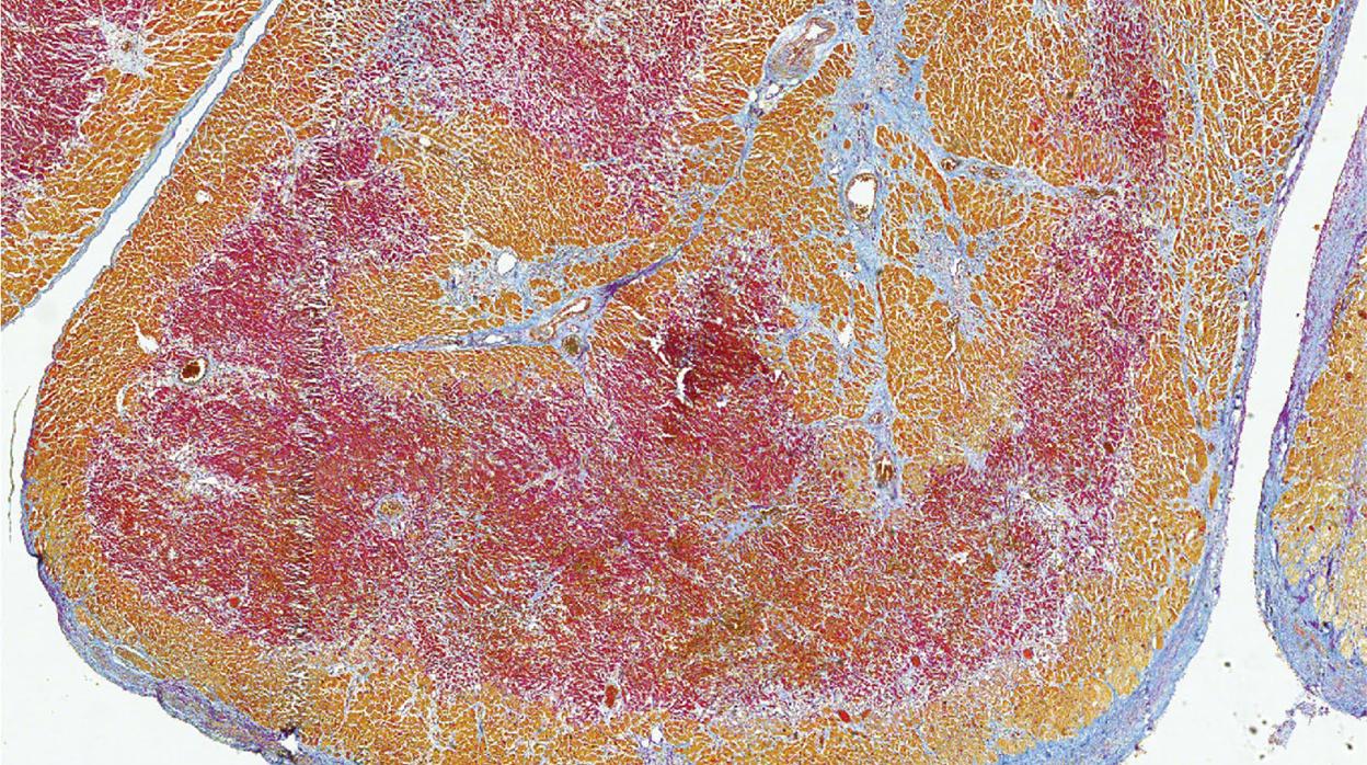 Identifican células del corazón que responden al infarto y aumentan las ...